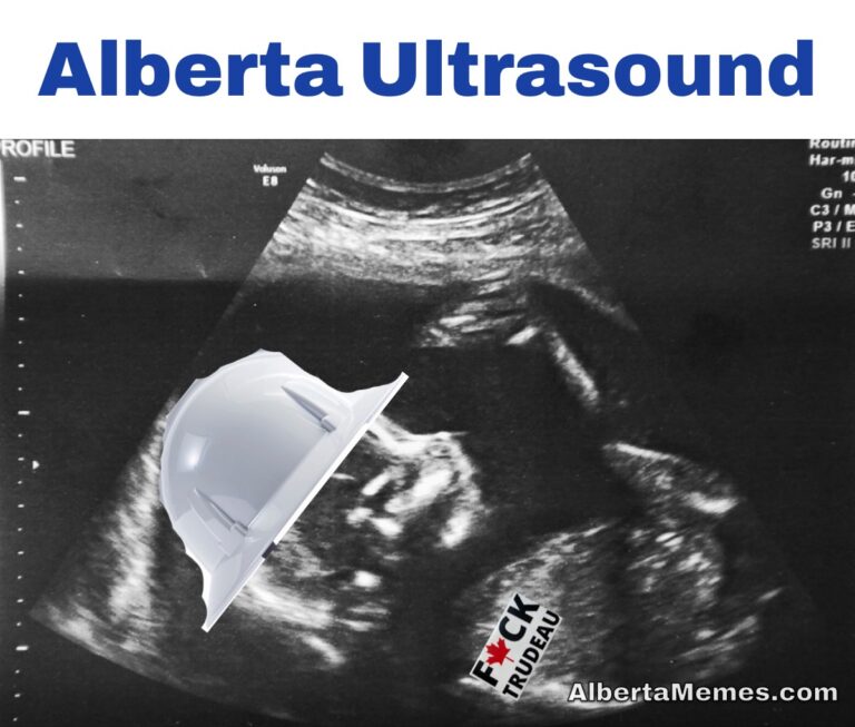 Here’s what Alberta Ultrasounds look like meme - Alberta Memes
